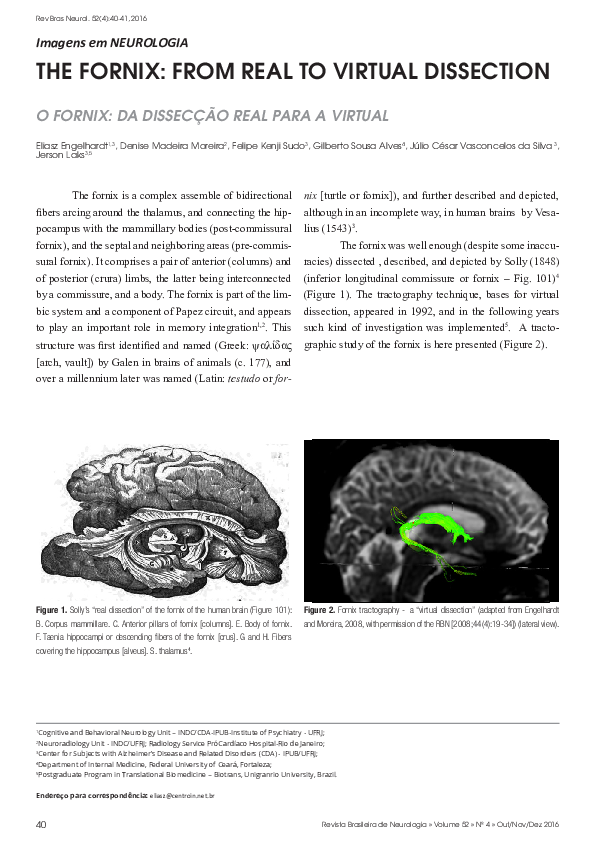 (PDF) The Fornix: From Real to Virtual Dissection