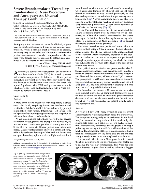 (PDF) Nuss and Aortopexy for Bronchomalacia Treatment