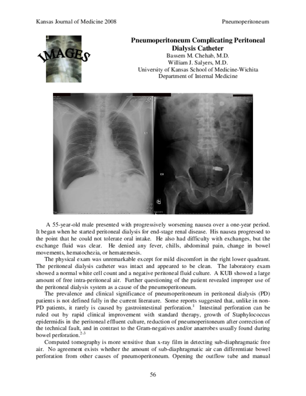 (PDF) Pneumoperitoneum Complicating Peritoneal Dialysis Catheter ...