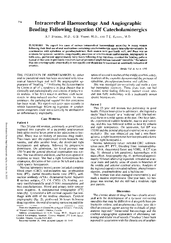 (PDF) Intracerebral haemorrhage and angiographic beading following ...