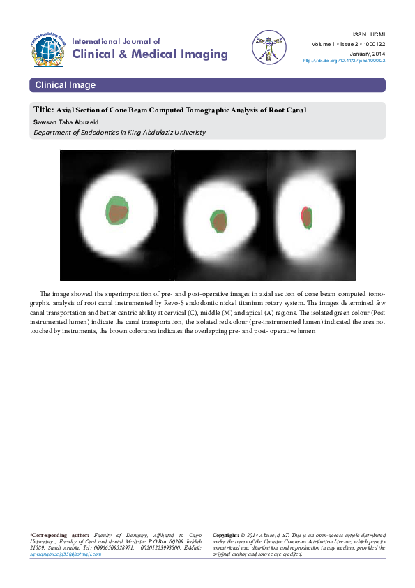 (PDF) Axial Section of Cone Beam Computed Tomographic Analysis of Root Canal