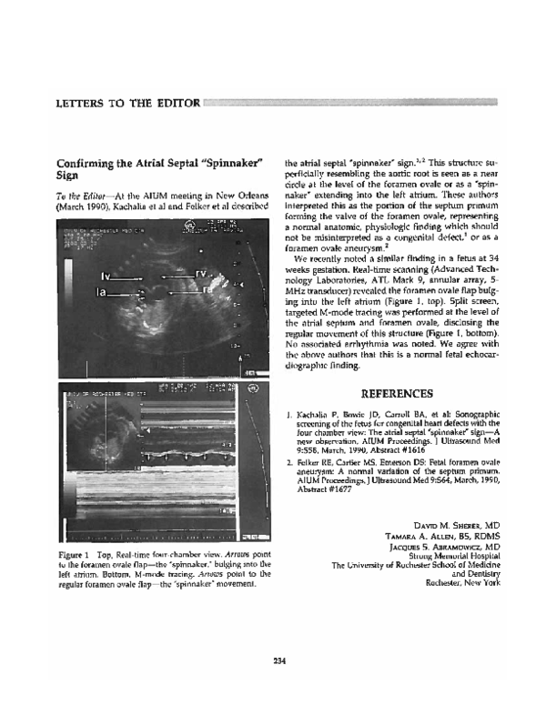 (PDF) Confirming the atrial septal “spinnaker” sign | Jacques ...