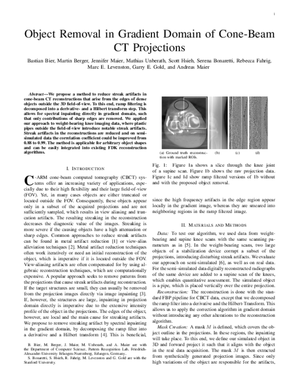 Pdf Object Removal In Gradient Domain Of Cone Beam Ct Projections