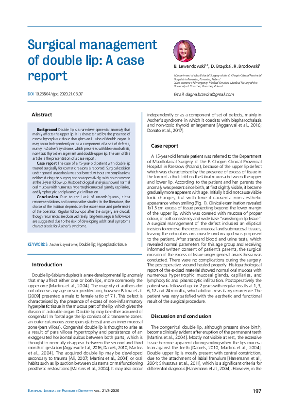 (PDF) Surgical management of double lip: A case report