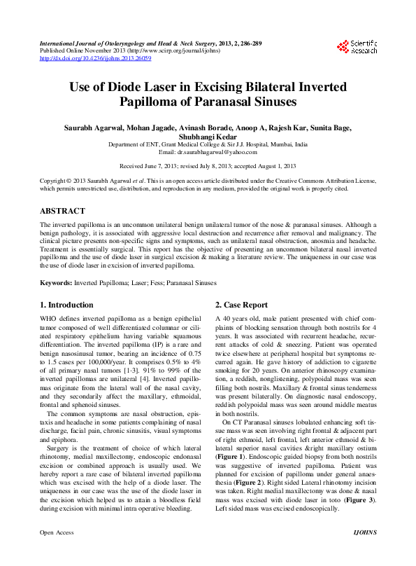 (PDF) Use of Diode Laser in Excising Bilateral Inverted Papilloma of ...
