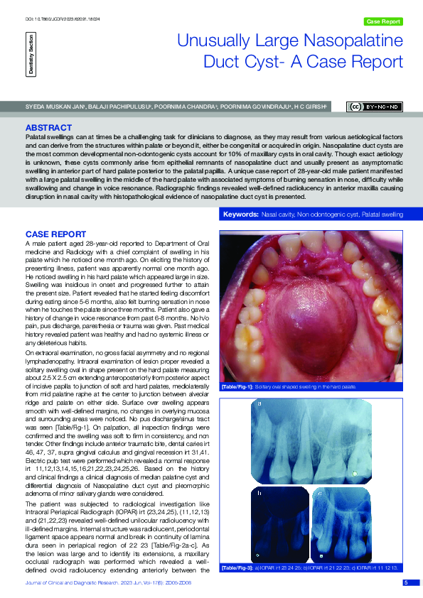 (PDF) Unusually Large Nasopalatine Duct Cyst- A Case Report