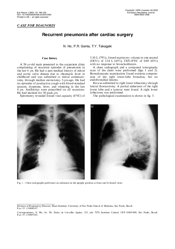 (PDF) Recurrent pneumonia after cardiac surgery