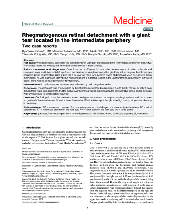 (PDF) Rhegmatogenous retinal detachment with giant retinal tear in a ...
