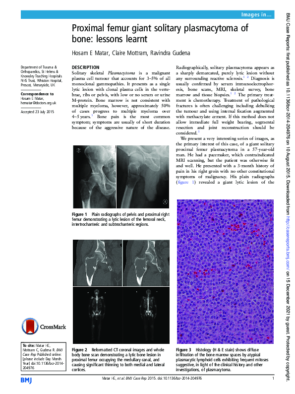 (PDF) Proximal femur giant solitary plasmacytoma of bone: lessons learnt