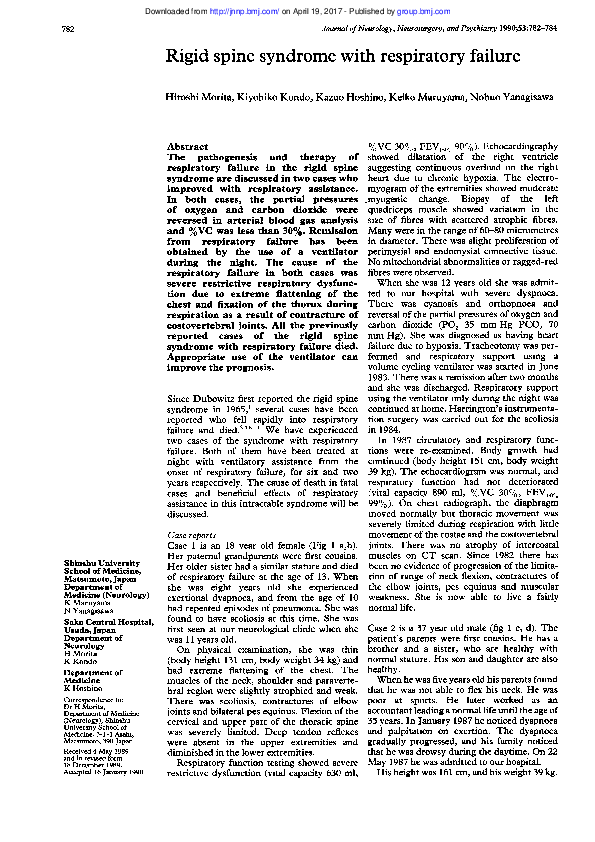 (PDF) Rigid spine syndrome with respiratory failure