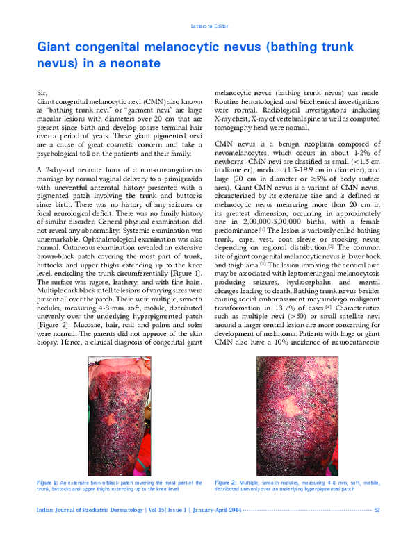 (PDF) Giant congenital melanocytic nevus (bathing trunk nevus) in a neonate