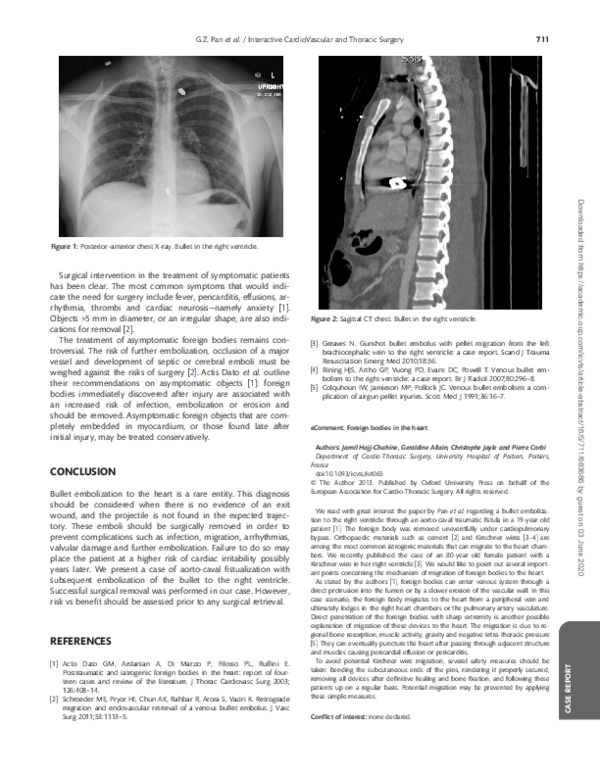 (PDF) eComment. Foreign bodies in the heart