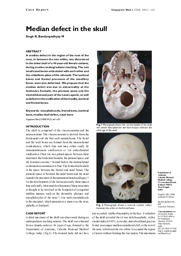 (PDF) Median defect in the skull
