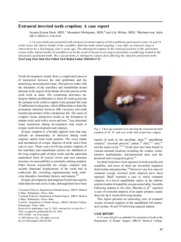 (PDF) Extraoral inverted teeth eruption: a case report