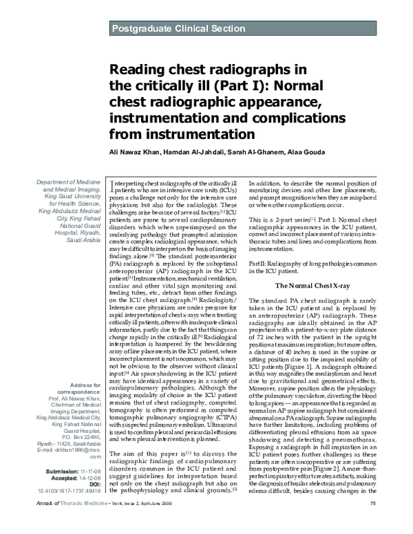 (PDF) Reading chest radiographs in the critically ill (Part I): Normal ...