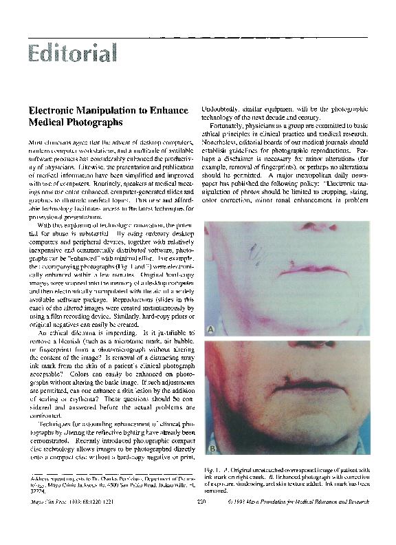 (PDF) Electronic Manipulation to Enhance Medical Photographs