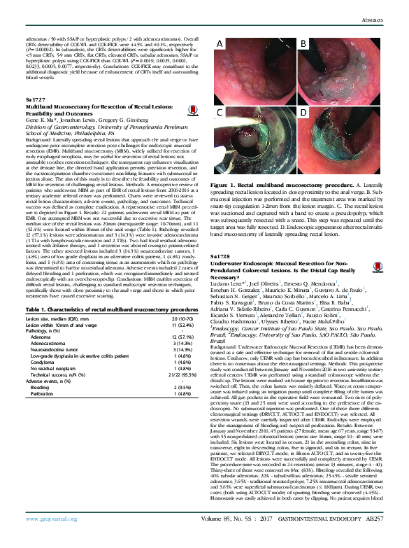 (PDF) Sa1728 Underwater Endoscopic Mucosal Resection for Non-Pendulated ...
