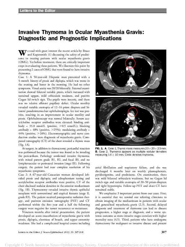 (PDF) Invasive Thymoma Cases in Ocular Myasthenia Gravis