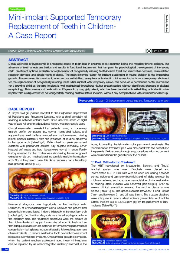(PDF) Mini-implant Supported Temporary Replacement of Teeth in ...