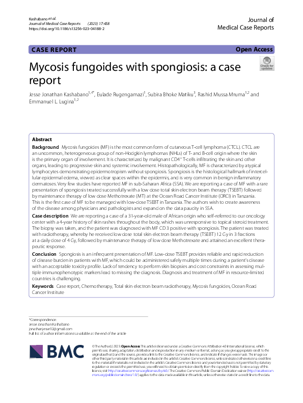 (PDF) Mycosis fungoides with spongiosis: a case report | Rashid Mruma - Academia.edu