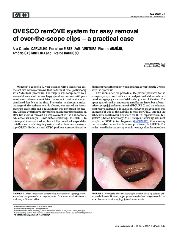 (PDF) Ovesco Remove System for Easy Removal of Over-The-Scope Clips - a ...