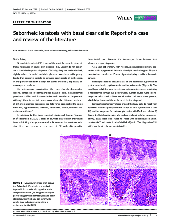 (PDF) Seborrheic keratosis with basal clear cells: Report of a case and ...