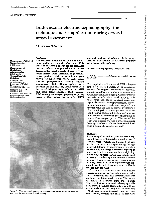 (PDF) Endovascular electroencephalography: the technique ...