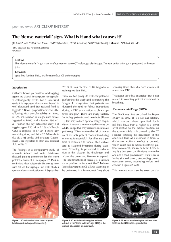 (PDF) The ‘dense waterfall’ sign. What is it and what causes it ...