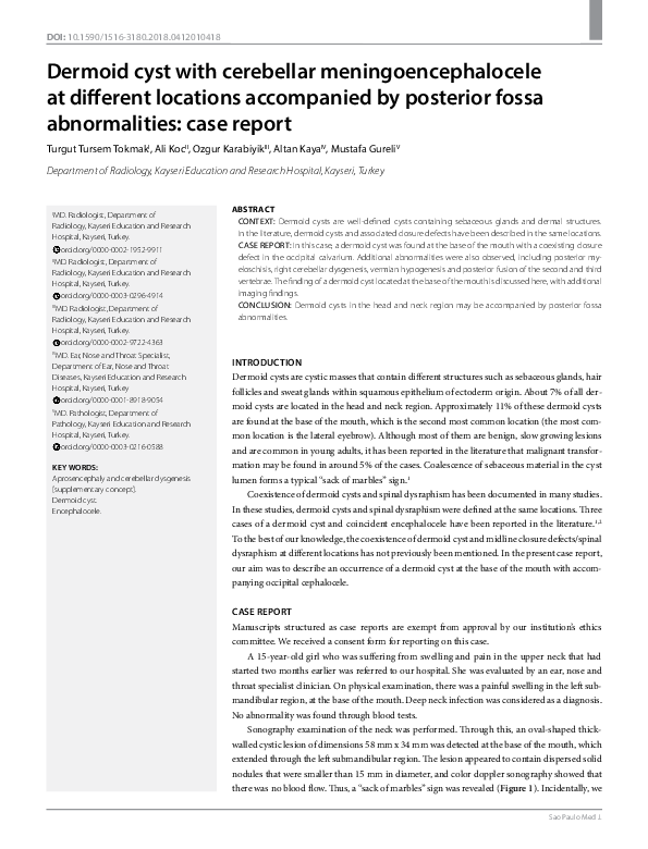 (PDF) Dermoid cyst with cerebellar meningoencephalocele at different ...