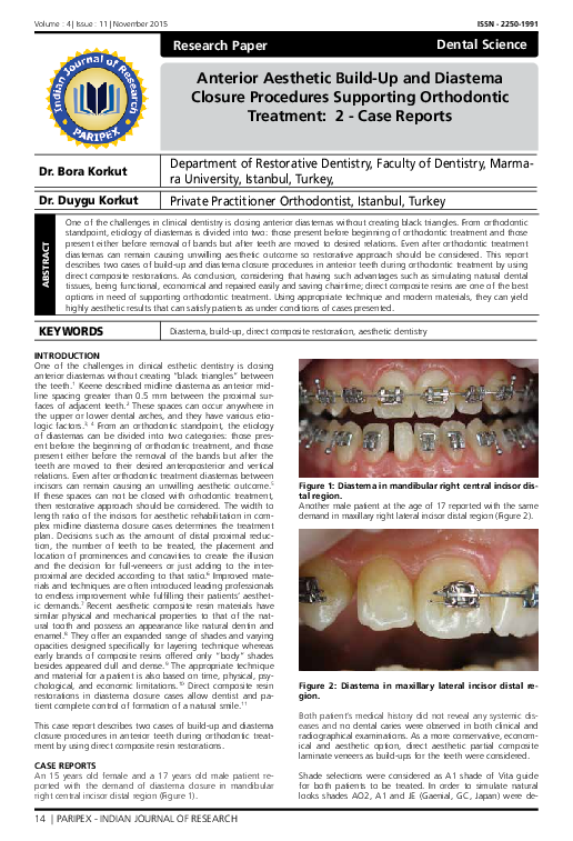 (PDF) Anterior Aesthetic Build–Up and Diastema Closure Procedures ...