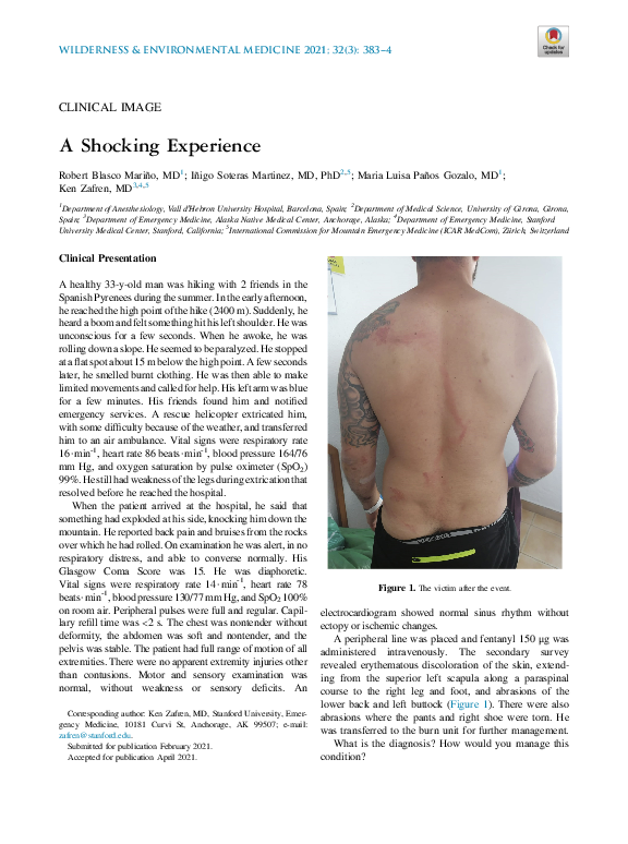 (PDF) A Shocking Experience