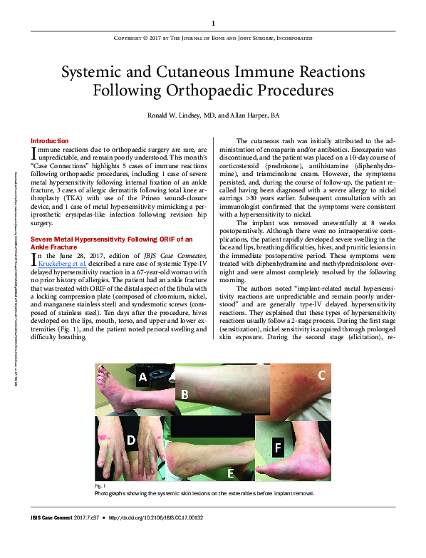 (PDF) Systemic and Cutaneous Immune Reactions Following Orthopaedic ...