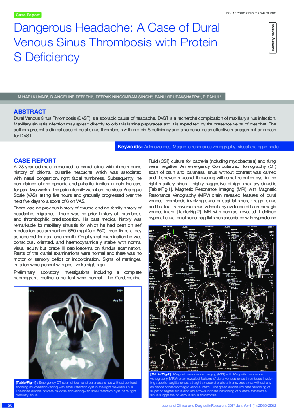 (PDF) Dangerous Headache: A Case of Dural Venous Sinus Thrombosis with ...
