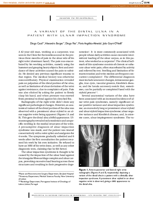 (PDF) Images in rheumatology. A variant of the distal ulna in a patient ...