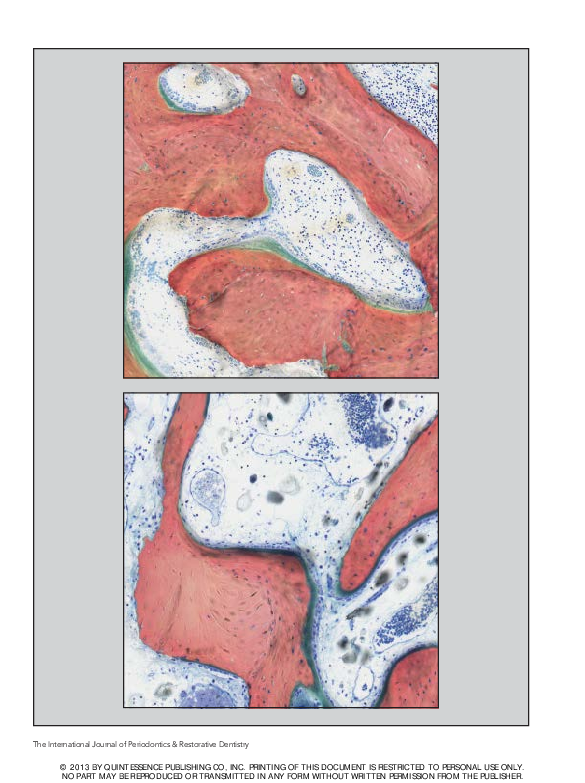 (PDF) Histomorphometric Comparison of Different Concentrations of ...