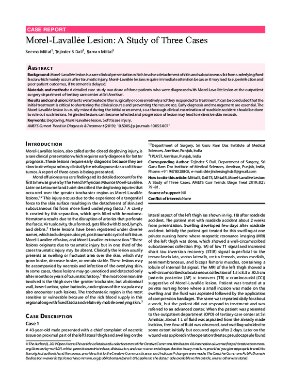 (PDF) Morel-Lavallée Lesion: A Study of Three Cases | seema mittal ...