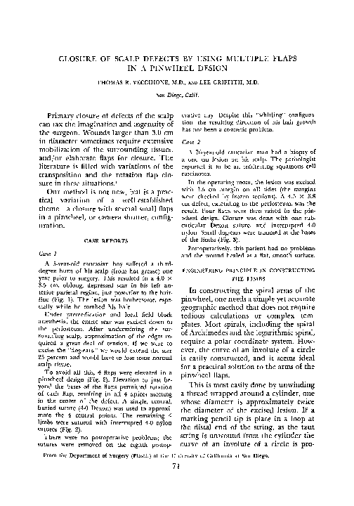 Pdf Closure Of Scalp Defects By Using Multiple Flaps In A Pinwheel Design