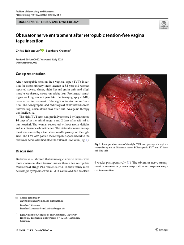 (PDF) Obturator nerve entrapment after retropubic tension-free vaginal ...