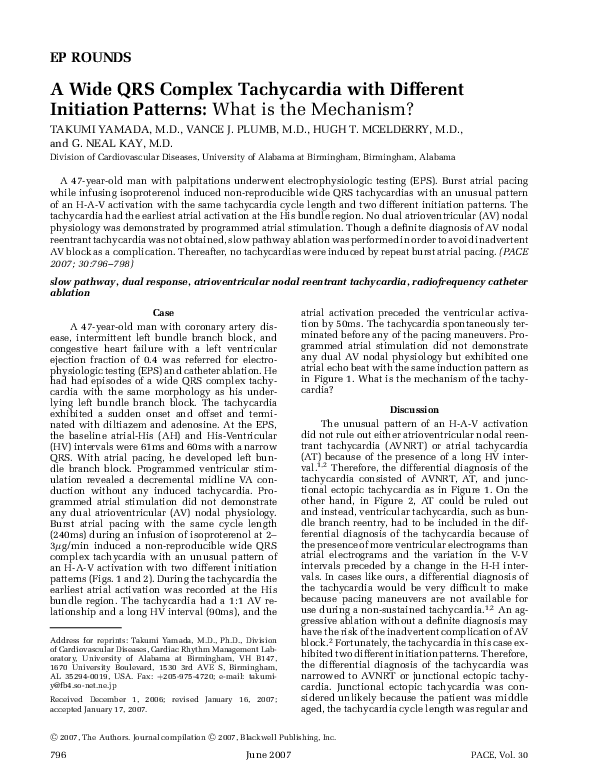 (PDF) A Wide QRS Complex Tachycardia with Different Initiation Patterns ...