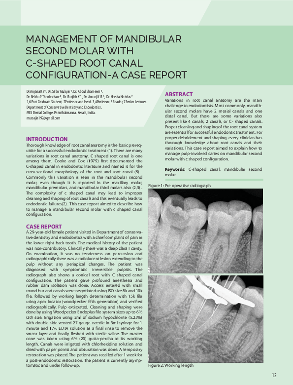 (PDF) MANAGEMENT OF MANDIBULAR SECOND MOLAR WITH C-SHAPED ROOT CANAL CONFIGURATION-A CASE REPORT