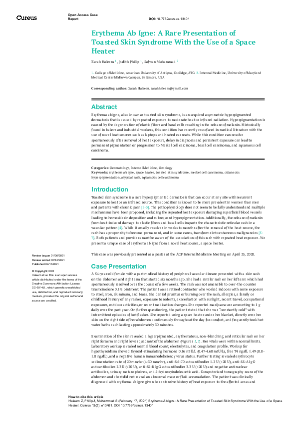 (PDF) Erythema Ab Igne: A Rare Presentation of Toasted Skin Syndrome ...