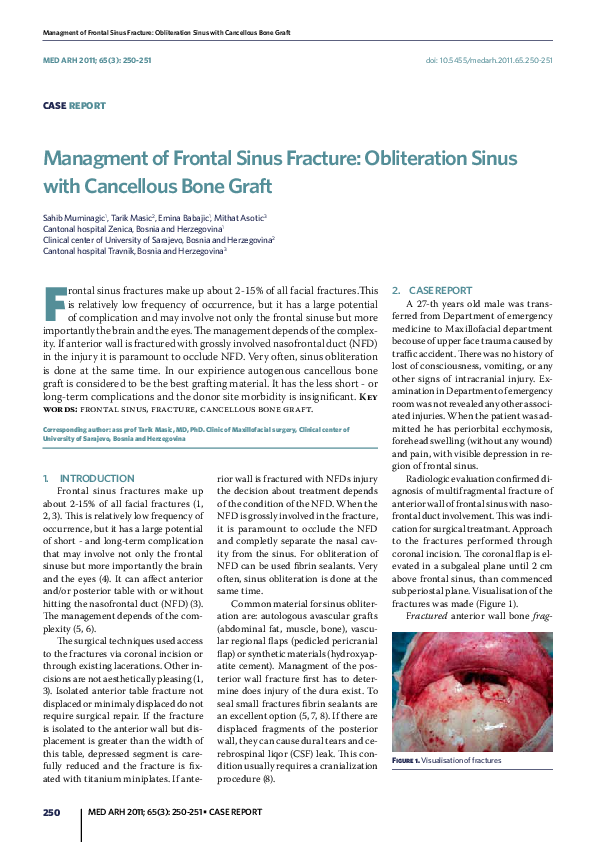 (PDF) Managment of Frontal Sinus Fracture: Obliteration Sinus with ...
