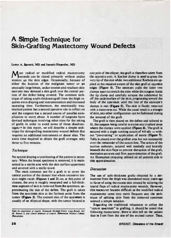 (PDF) A simple technique for skin grafting mastectomy wound defects