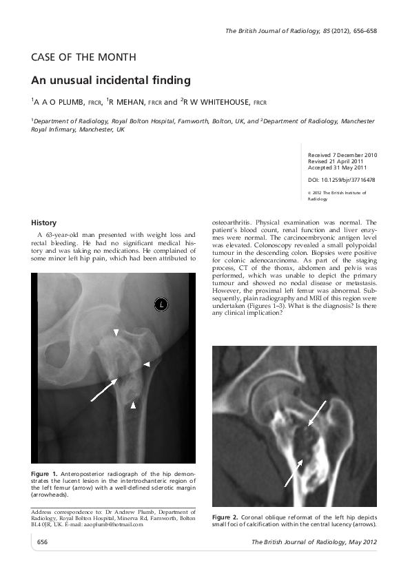 (PDF) An unusual incidental finding