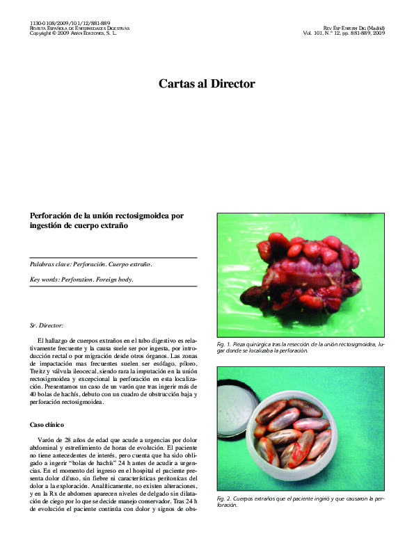 (PDF) Perforación de la unión rectosigmoidea por ingestión de cuerpo ...