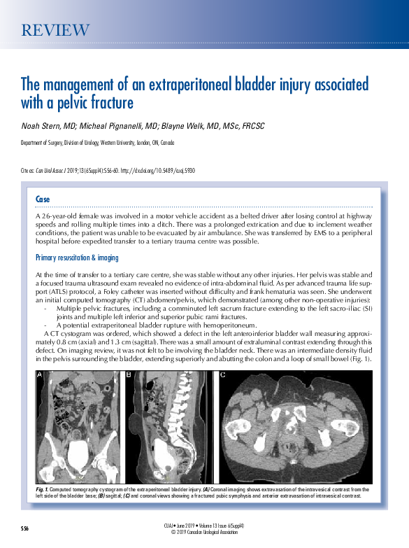 (PDF) Management of Extraperitoneal Bladder Injury with Pelvic Fracture