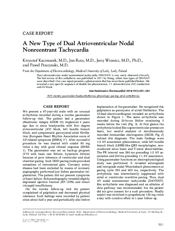 (PDF) A New Type of Dual Atrioventricular Nodal Nonreentrant Tachycardia