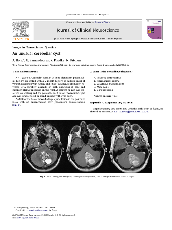 (PDF) An unusual cerebellar cyst