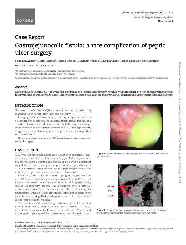 (PDF) Gastrojejunocolic fistula: a rare complication of peptic ulcer ...