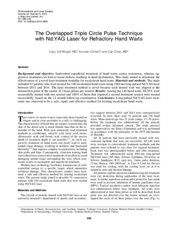The Overlapped Triple Circle Pulse Technique with Nd:YAG Laser for ...